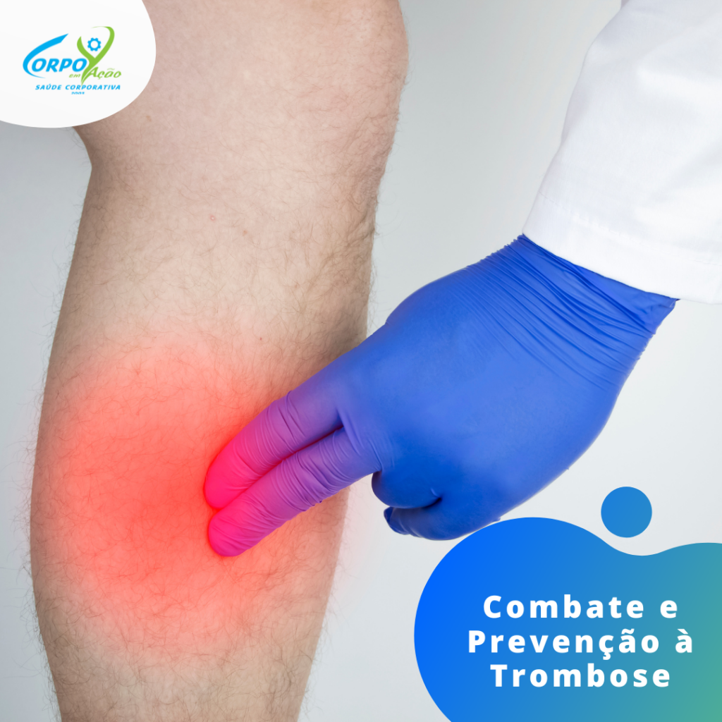 Combate e Prevenção à Trombose - Corpo em Ação